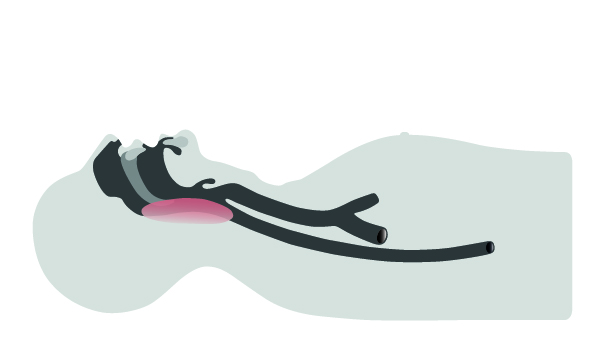 Difficult Airway Management Training Simulator – BT GLOBAL