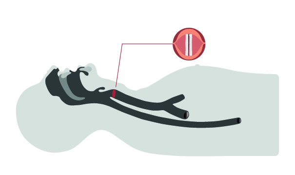 Difficult Airway Management Training Simulator – BT GLOBAL